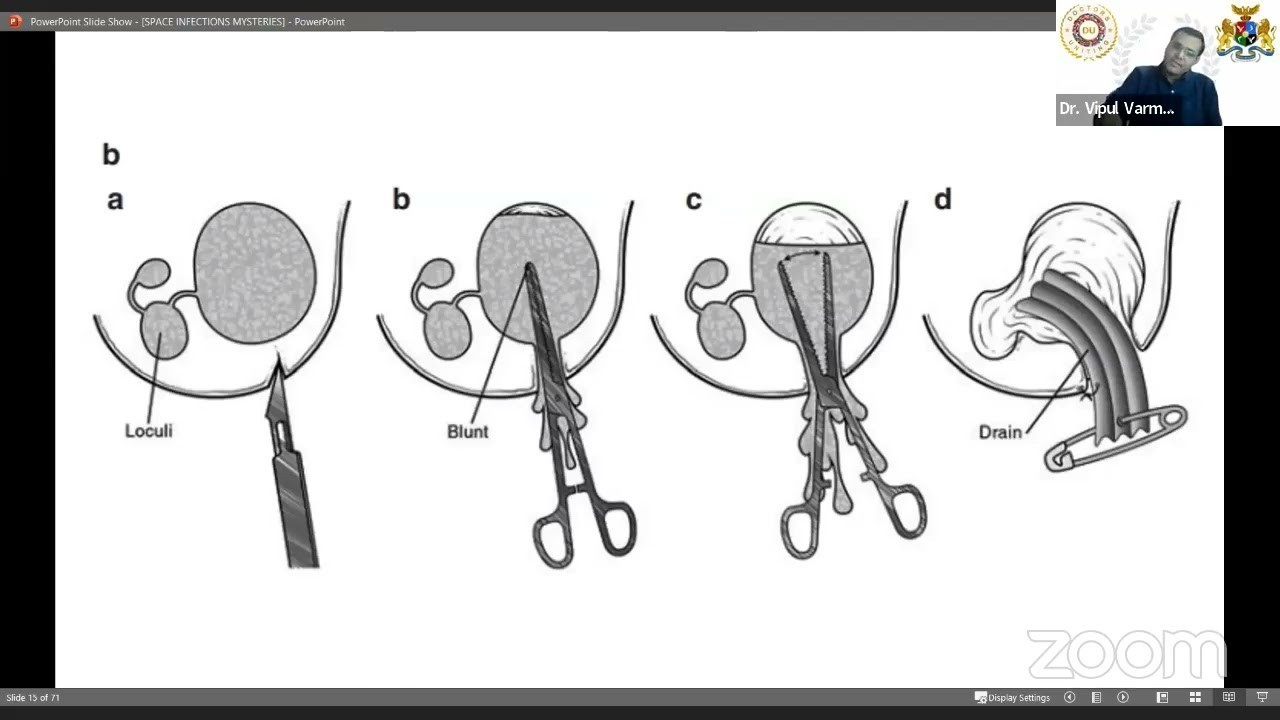 Dr. Vipul Varma on Space Infection Mysteries