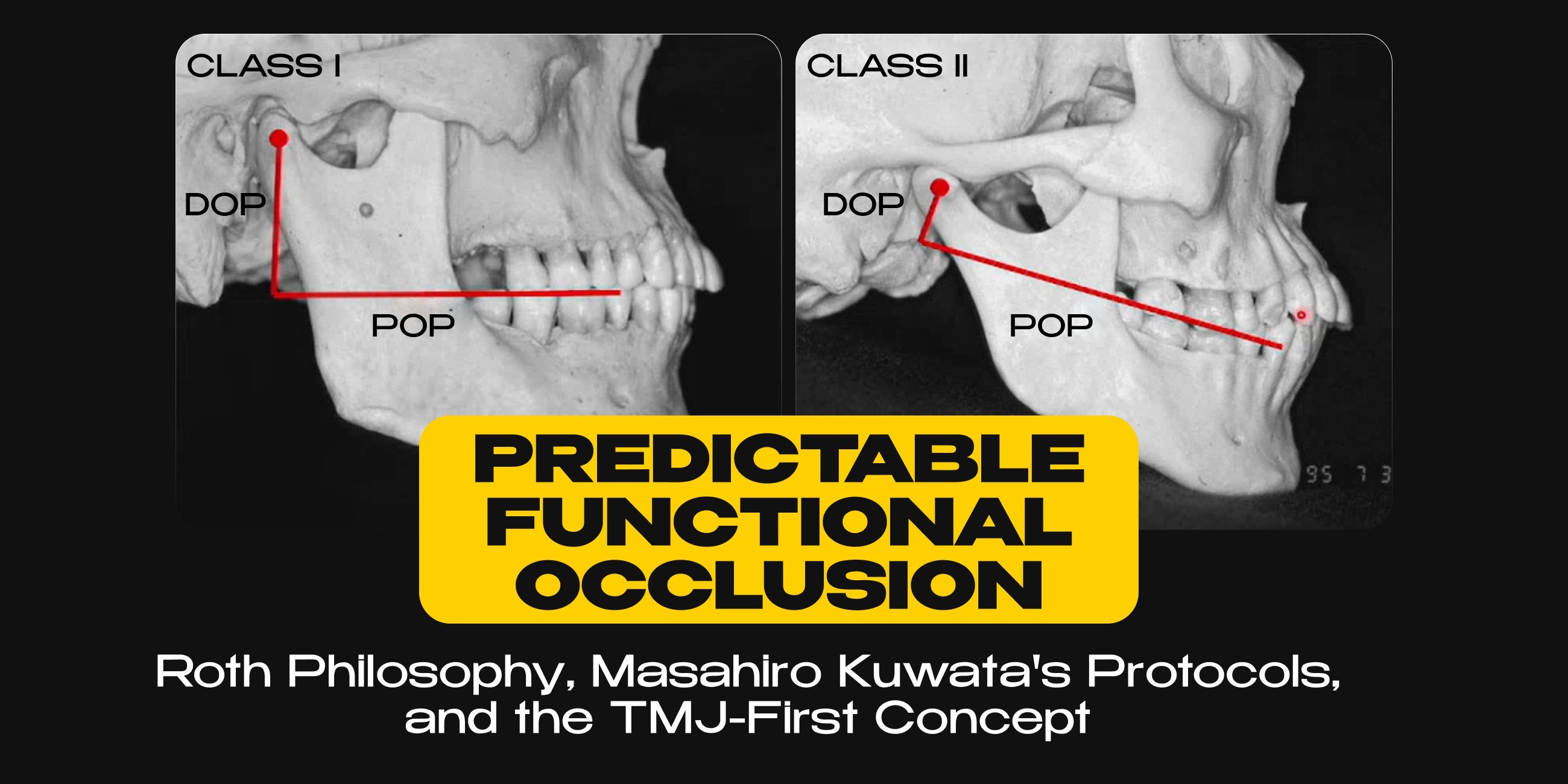 Role and Effectiveness of Orthodontics in the Treatment of Malocclusion ...