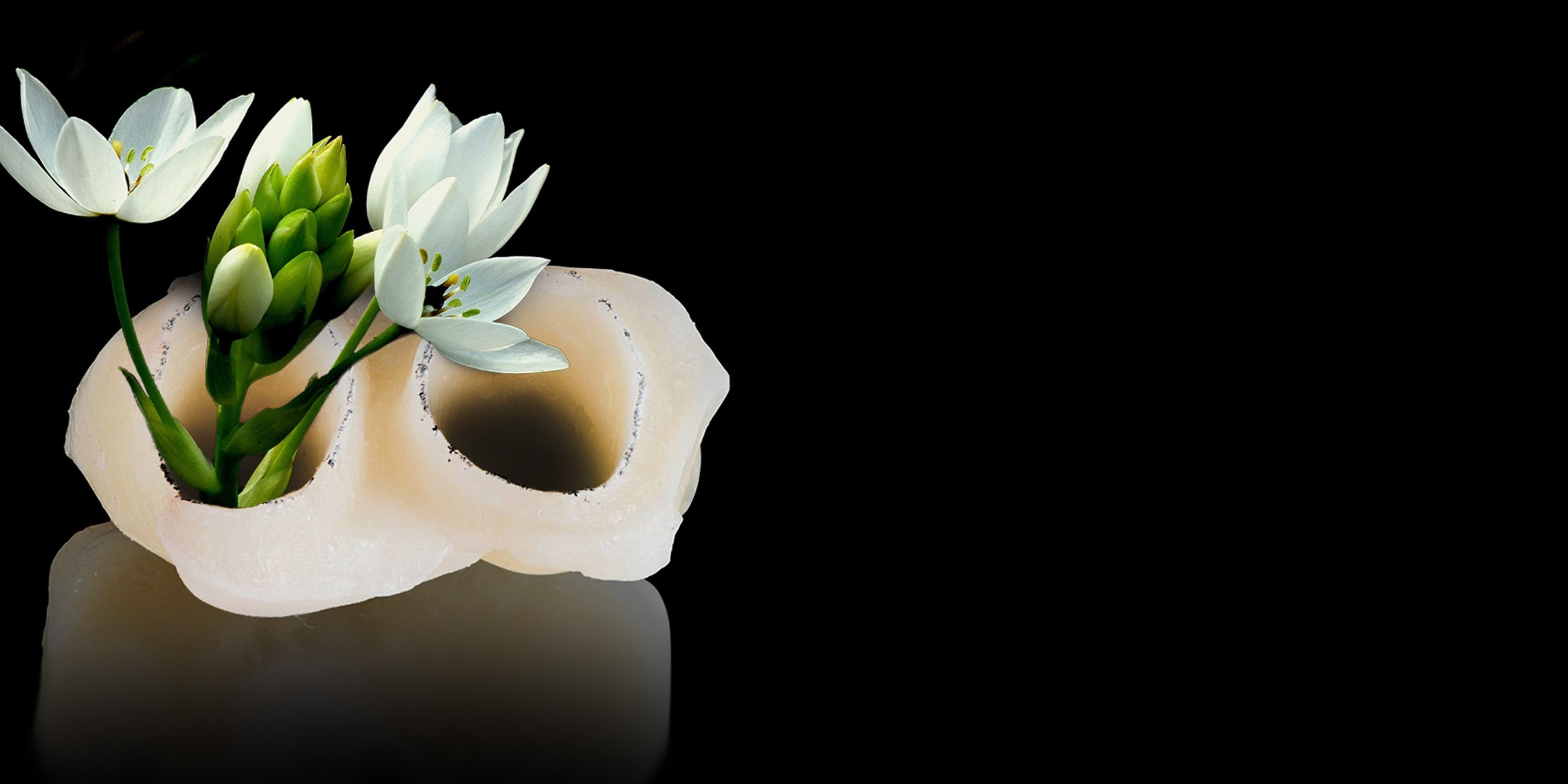 Webinar on the BOPT and Vertiprep, vertical preparations