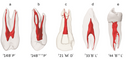 Understanding Root and Root Canal Morphology for Endodontic Treatments