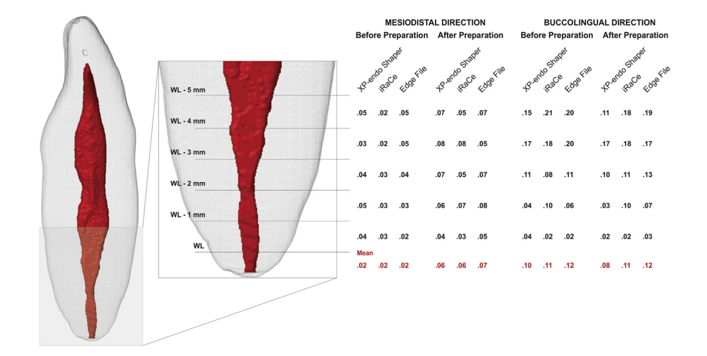 Comparative Study of XP-endo Shaper, iRaCe, and EdgeFile Systems Using ...