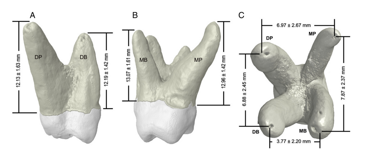 Study on the Anatomy of 4-Rooted Maxillary Second Molars Using Micro ...
