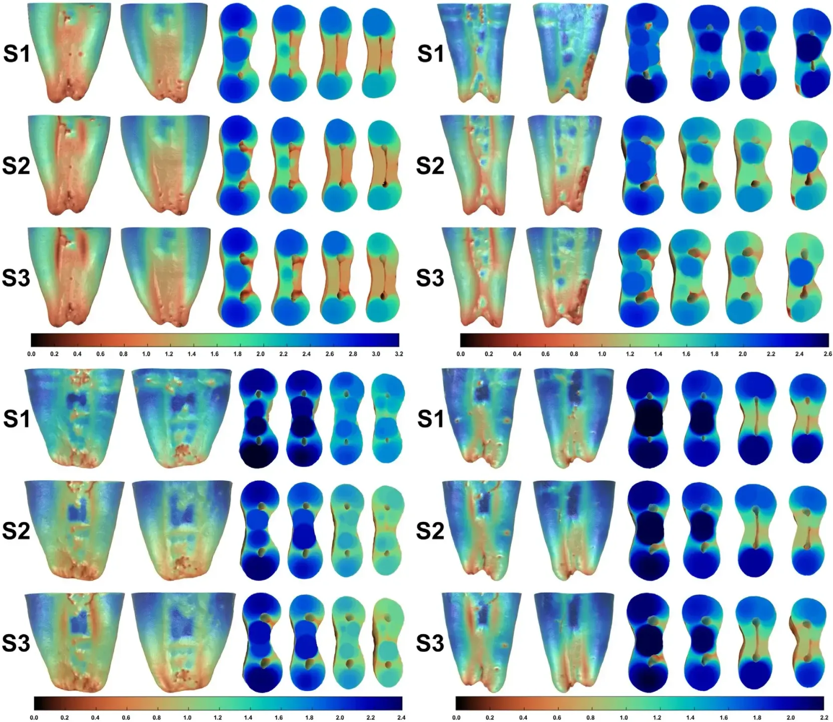 Taper in Endodontics: A Comparison of 0.06 vs 0.04 Files