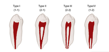 Understanding Root and Root Canal Morphology for Endodontic Treatments