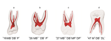 Understanding Root and Root Canal Morphology for Endodontic Treatments