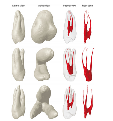 Comprensión de la Morfología Radicular y del Conducto Radicular para ...