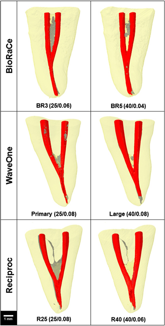 Comparação de Sistemas de Alargamento Apical em Endodontia