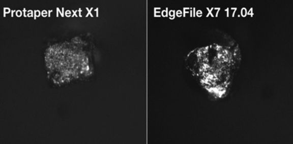 Advancements in Nickel-Titanium Rotary Instruments