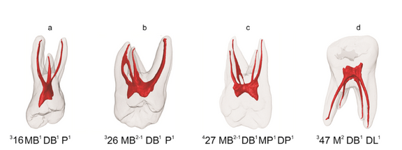 Comprensión de la Morfología Radicular y del Conducto Radicular para ...