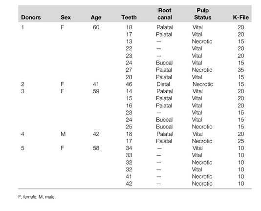 Comparative Study of Electronic Apex Locators Using Micro-CT Technology