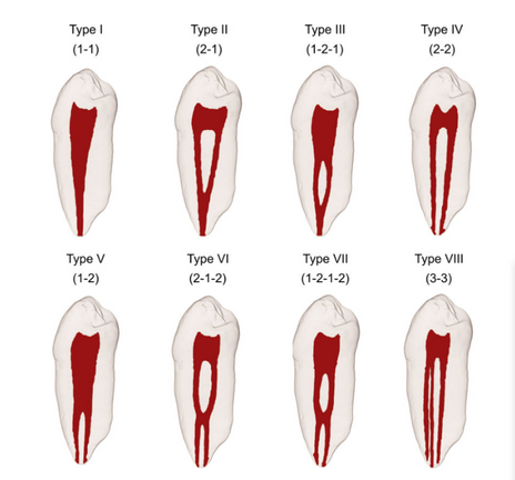 Comprensión de la Morfología Radicular y del Conducto Radicular para ...