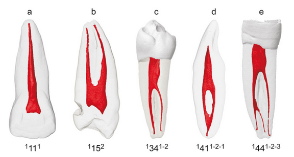 Comprensión de la Morfología Radicular y del Conducto Radicular para ...
