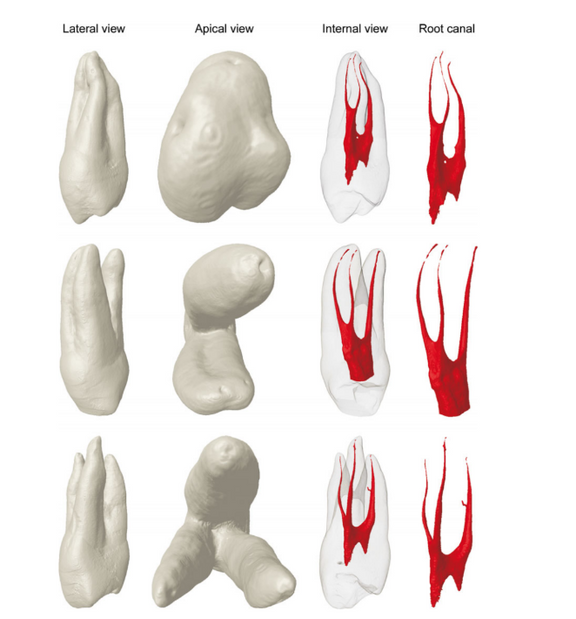 Understanding Root and Root Canal Morphology for Endodontic Treatments