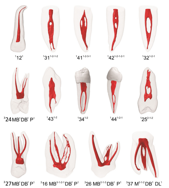 Comprensión de la Morfología Radicular y del Conducto Radicular para ...