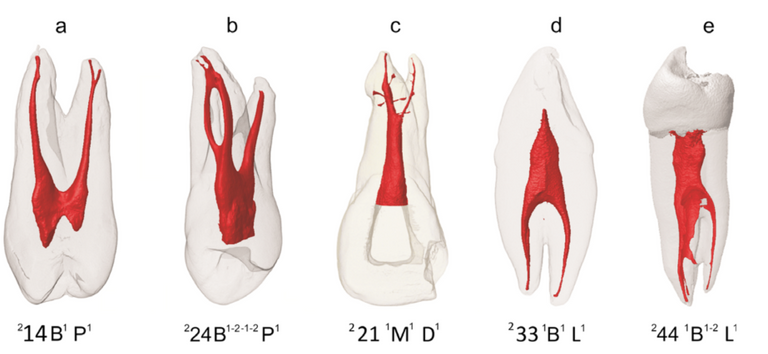 Comprensión de la Morfología Radicular y del Conducto Radicular para ...