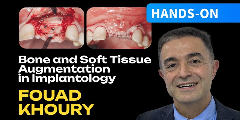 Khoury Technique Hands‑On Course | Bone & Soft Tissue Augmentation | 11 ...