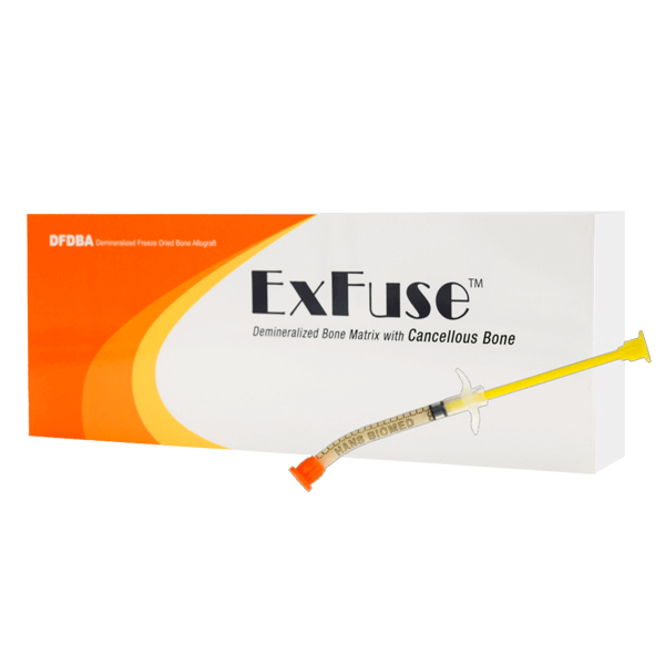 ExFuse DBM Putty with Cancellous Bone, 1cc Putty in Syringe. Anatomic based