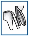 MD-ring with flat tines 1.167(1 pc.)